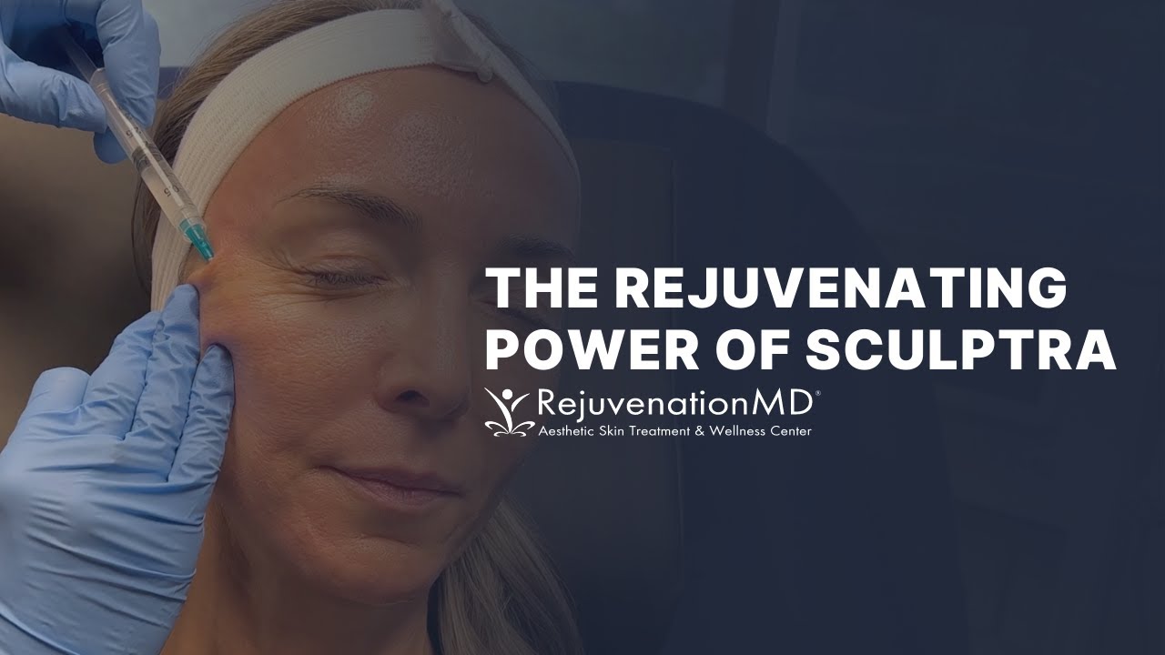 Liquid Facelift with Sculptra - YouTube