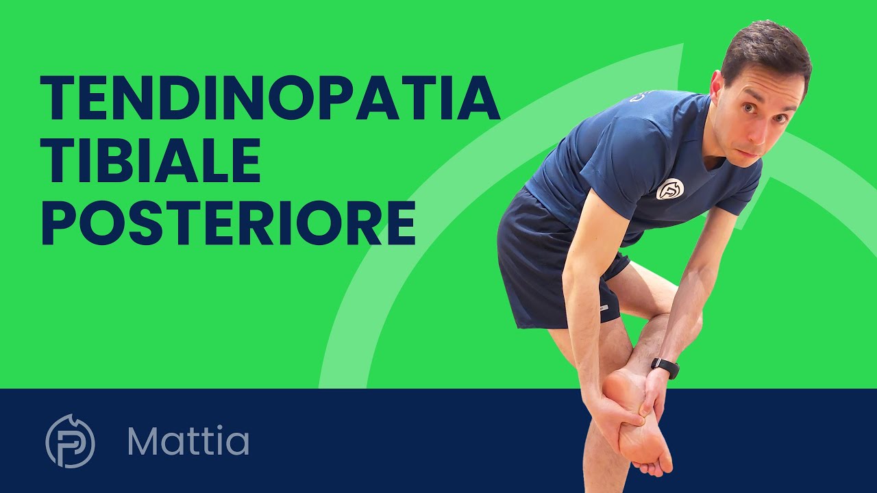 TENDINOPATIA al muscolo TIBIALE POSTERIORE, dolore all'ARCO PLANTARE ...