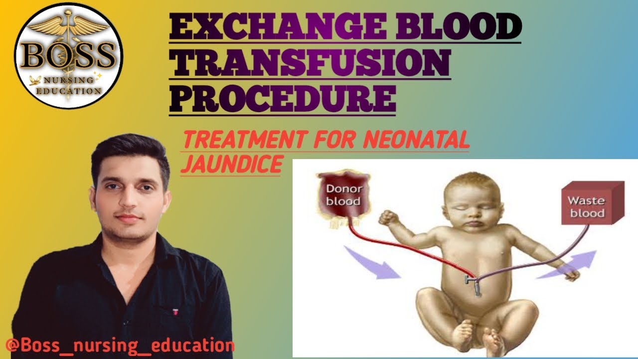 EXCHANGE BLOOD TRANSFUSION PROCEDURE|| NEONATAL JAUNDICE TREATMENT|| # ...