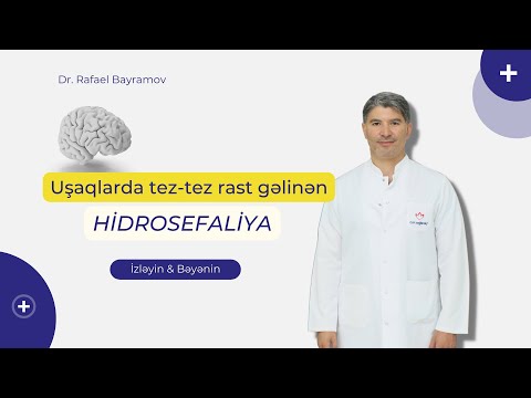 Uşaqlar arasında tez-tez rast gəlinən Hidrosefaliya xəstəliyi. Bu xəstəliyin səbəbləri nədir?