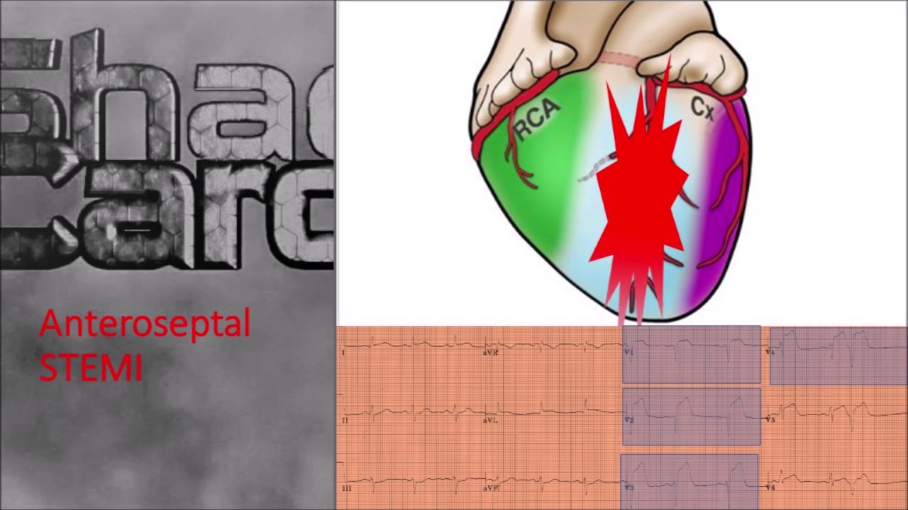 12 Lead Practice Part Two 2 - YouTube