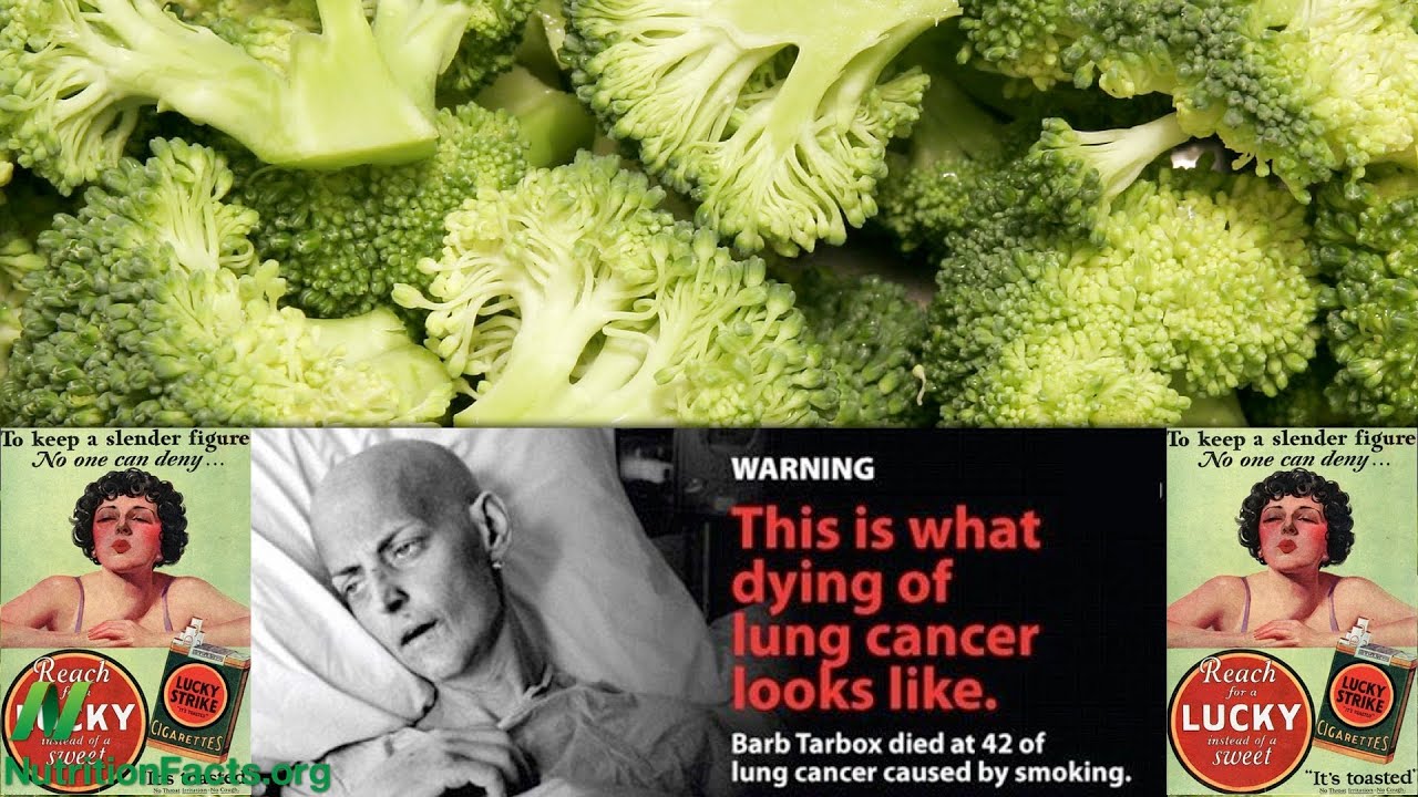 Lung Cancer Metastases and Broccoli - YouTube