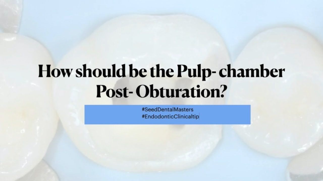 Seed Dental Masters - How the pulp chamber should be Post obturation ...