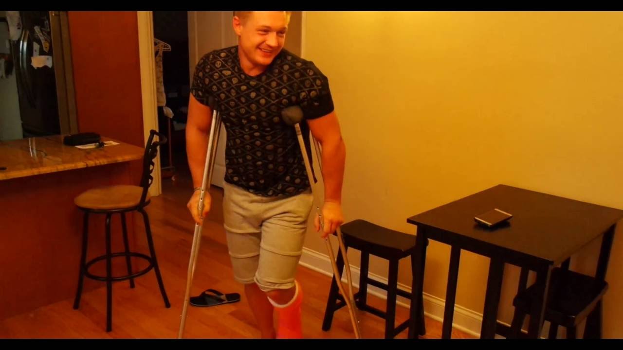 Short leg cast adventure - YouTube