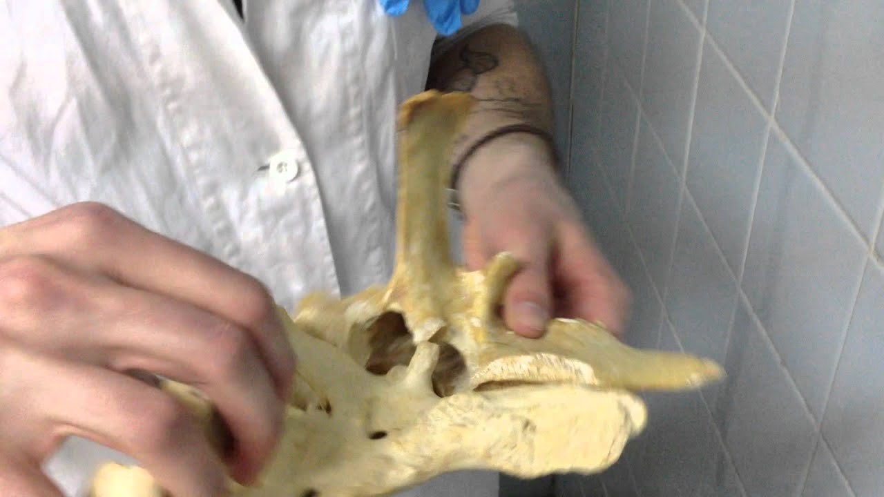 Bedrové stavce pokračovanie - YouTube