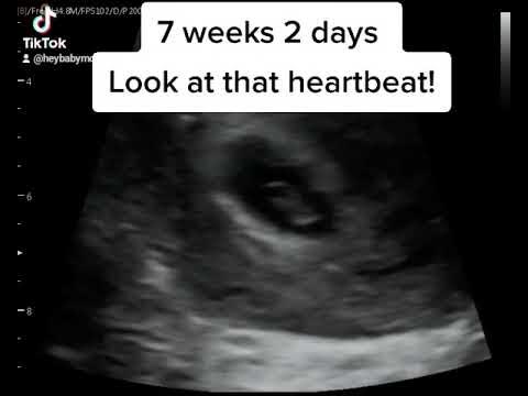 Flickering Heartbeat at 7 weeks 2 days on the Pregnancy Ultrasound - YouTube