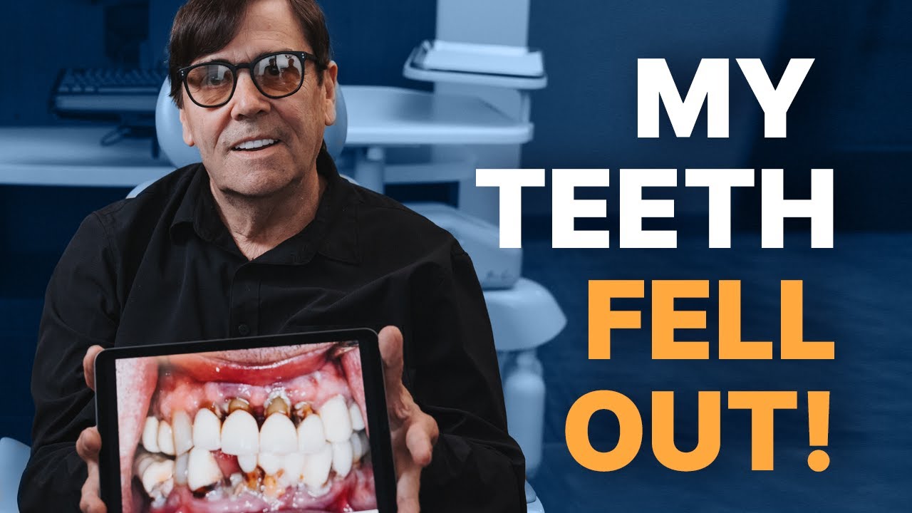 The Embarrassing Moment My Teeth Started Falling Out - YouTube