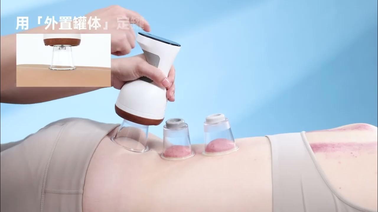 艾益生砭石罐罐推🔥深層出痧, 輕鬆減壓💟走罐 | 閃罐 | 定罐 👉人體工學設計抓握無需費力 - YouTube 艾益生砭石罐罐推🔥深層出痧, 輕鬆減壓💟走罐 | 閃罐 | 定罐 👉人體工學設計抓握無需費力 - YouTube