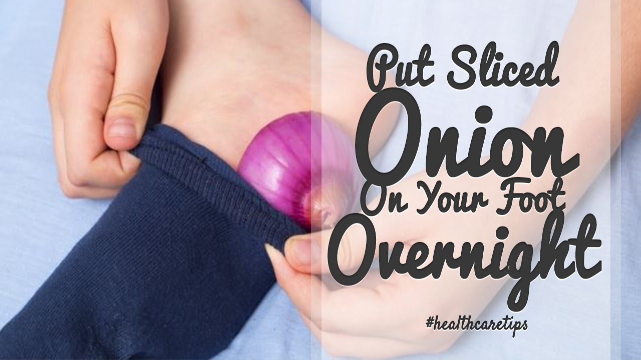 Health Benefits Put Sliced Onion On Your Foot Overnight - YouTube