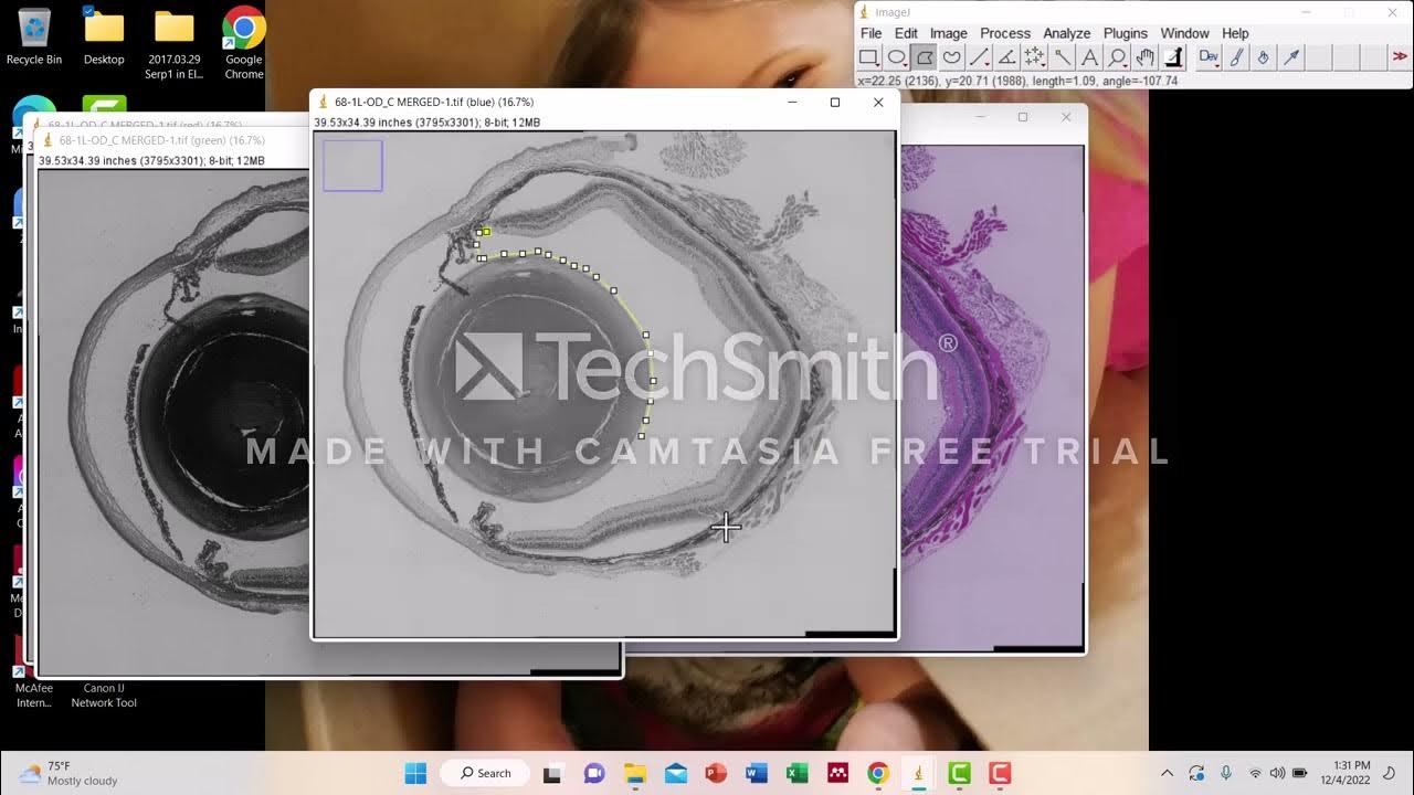 Histology Particle Count on ImageJ FINAL - YouTube
