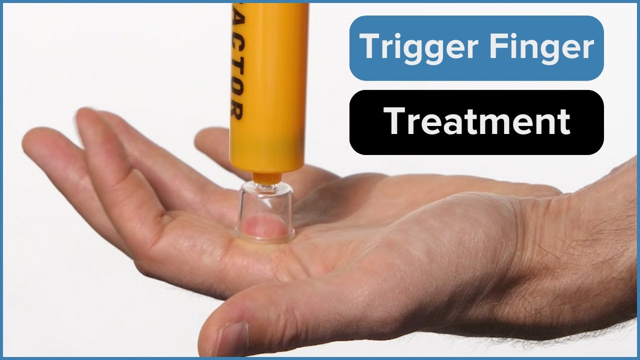 The Best Trigger Finger Exercise For Climbers - YouTube