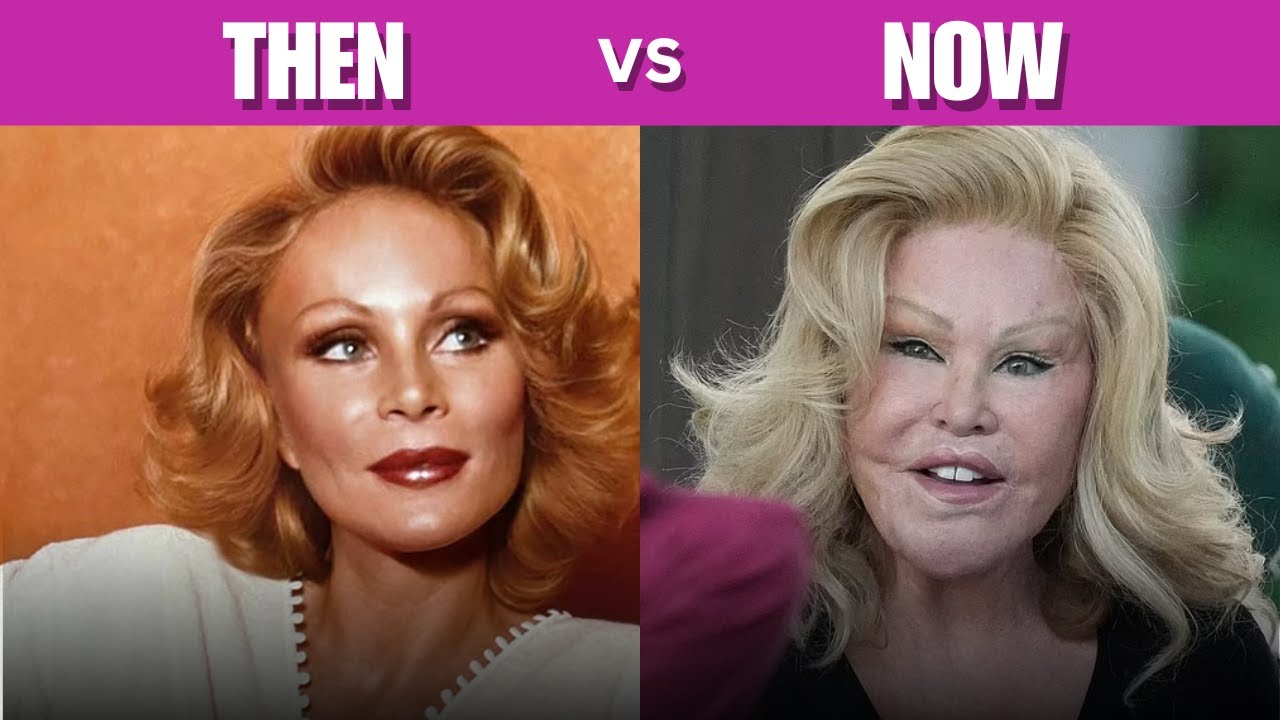 You Won't Recognize These Hollywood Stars After "BOTCHED" Plastic ...