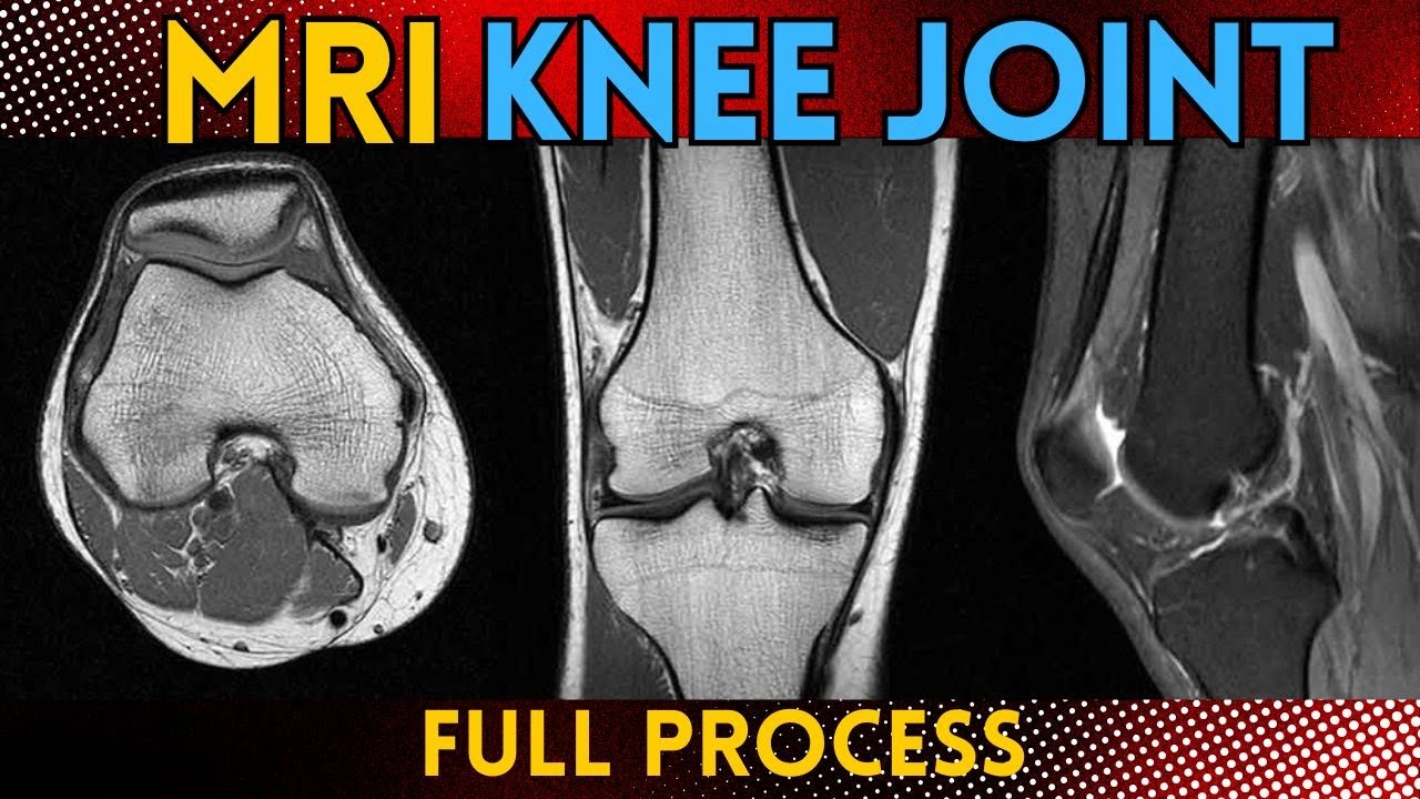 MRI knee joint planning and filming technique full tutorial | SIEMENS ...