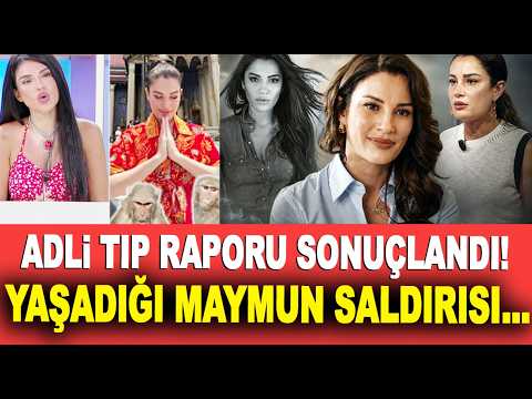 'Maymun ısırığı' iddiaları gündem olmuştu! Ece İrtem ön otopsi raporu çıktı / Magazin Turu