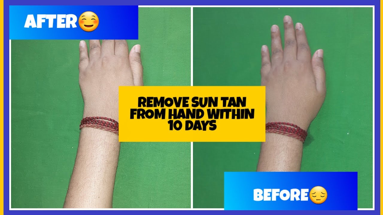Most Effective Sun Tan Removal with only 3 ingredients| Glamrs| DIY ...
