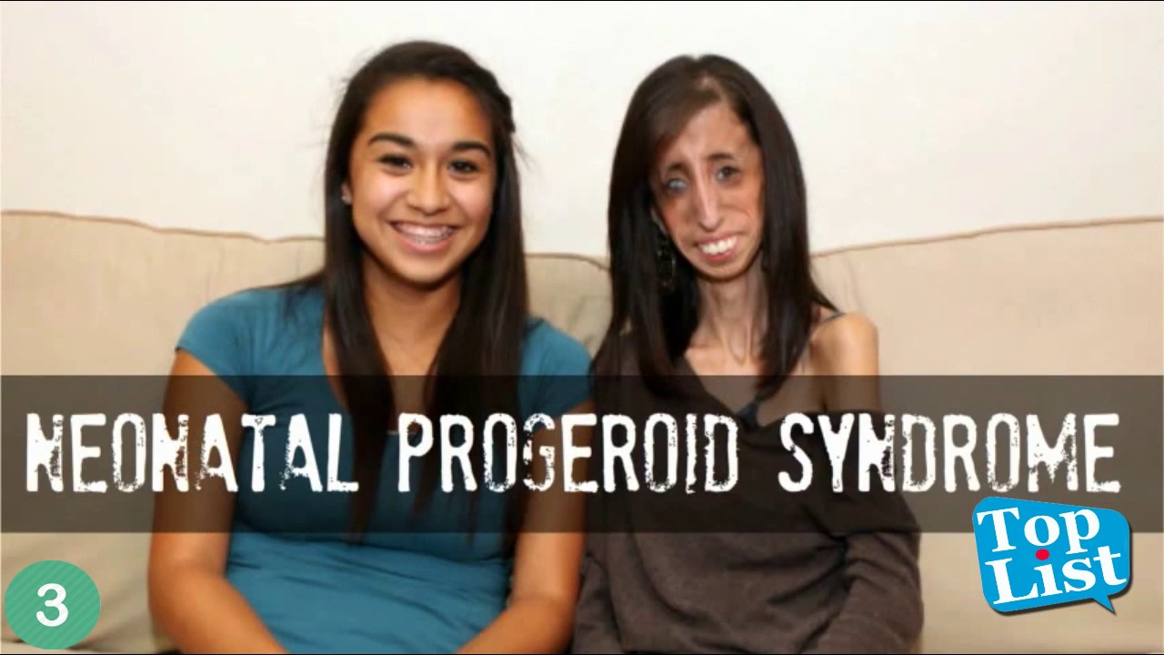 10 Shocking Bizarre Medical Conditions Part 2 - YouTube