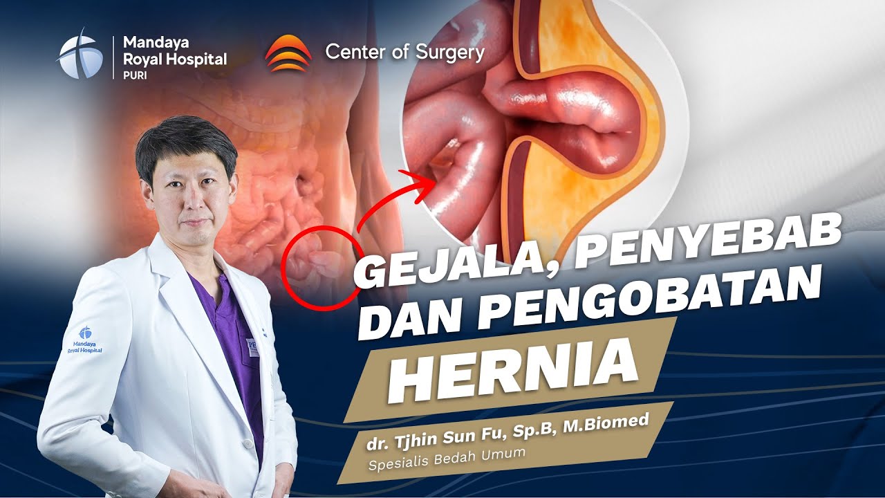 Jangan Remehkan Hernia, Inilah Pengobatan yang Tepat untuk Tangani ...
