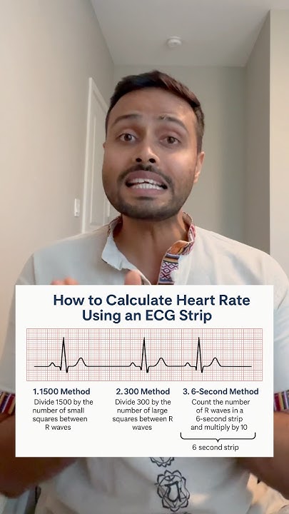 Master ECG Like a Pro: How to Calculate Heart Rate Using ECG Strip (Easy + Accurate Method ...