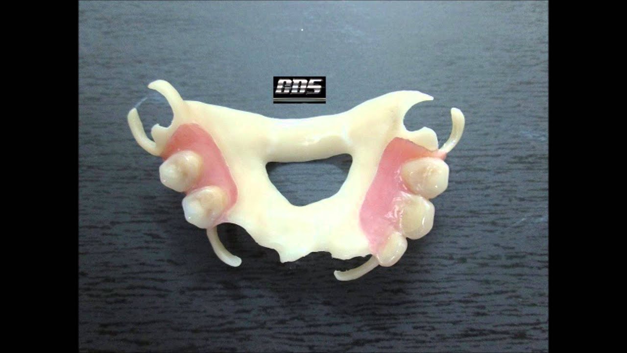 PROTESIS FLEXIBLE FLEXIACETAL-SABILEX LIMA-PERU - YouTube