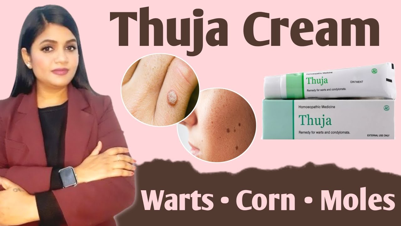 Warts corn moles removal cream | thuja cream uses | warts treatment ...