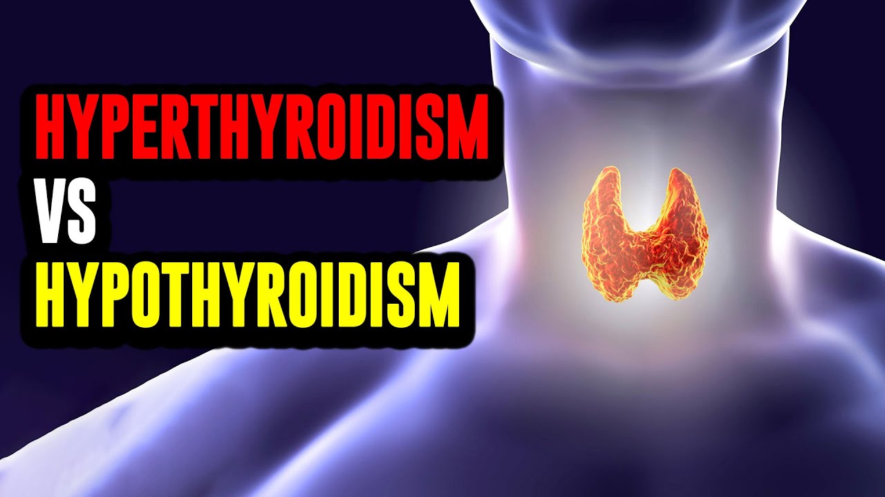 Hyperthyroidism vs Hypothyroidism - YouTube