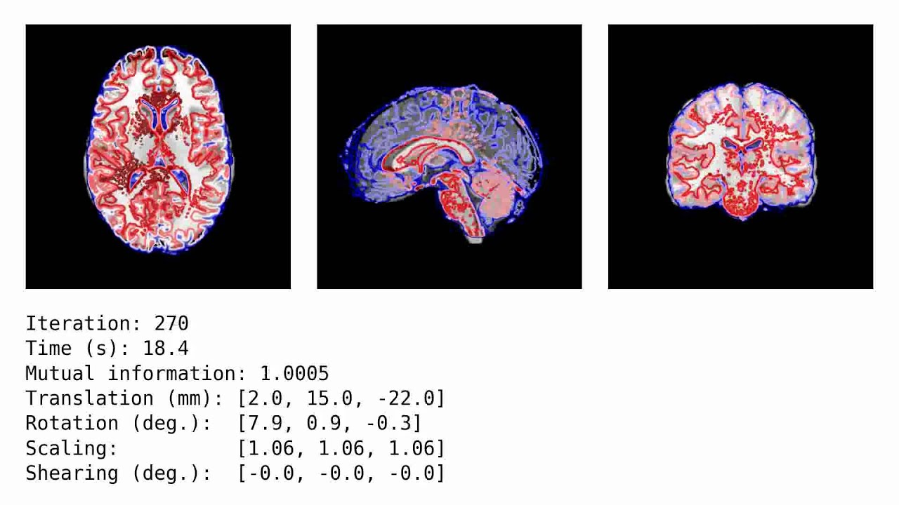 Medical Image Registration YouTube medical-image-registration-youtube