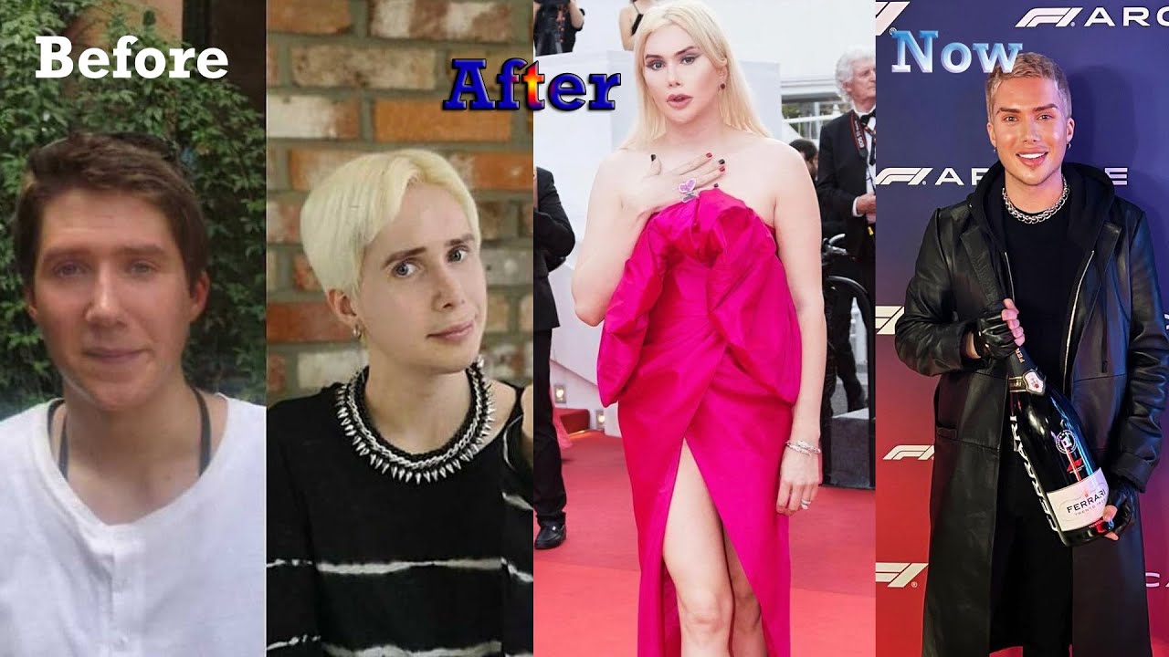 Oli becomes a man again after undergoing £230,000 plastic surgery to ...