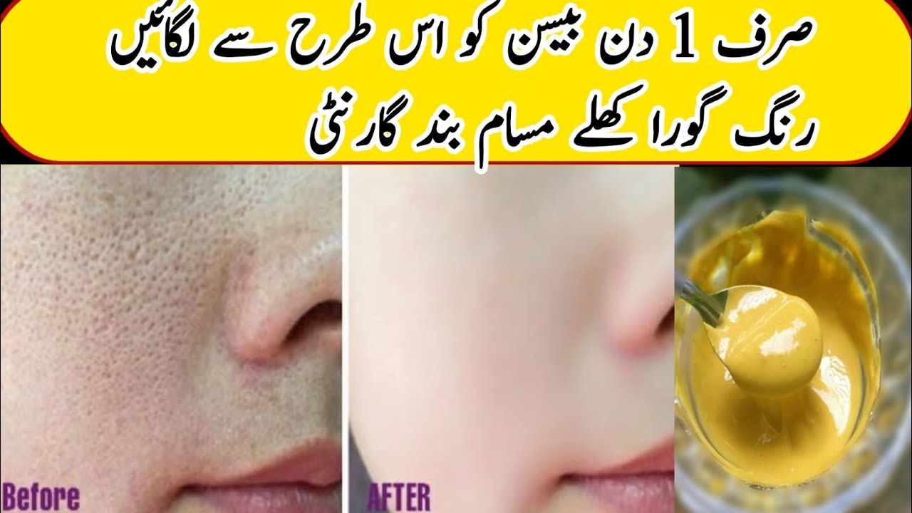 Besan face pack for glowing skinl BEST Skin Brightening Face Pack skin ...