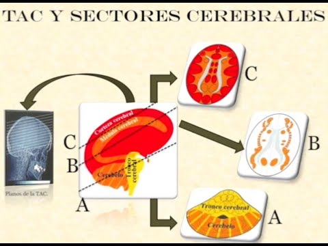 Los Focos de Hamer FH, primera parte - YouTube