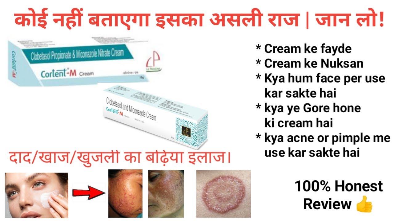 Cortent M cream uses in hindi - 🔥🔥 addhonest review 2022 - YouTube