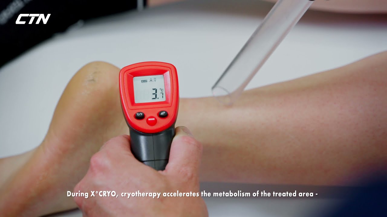 How To Use Cryotherapy On The Achilles Tendon l CTN.FI - YouTube