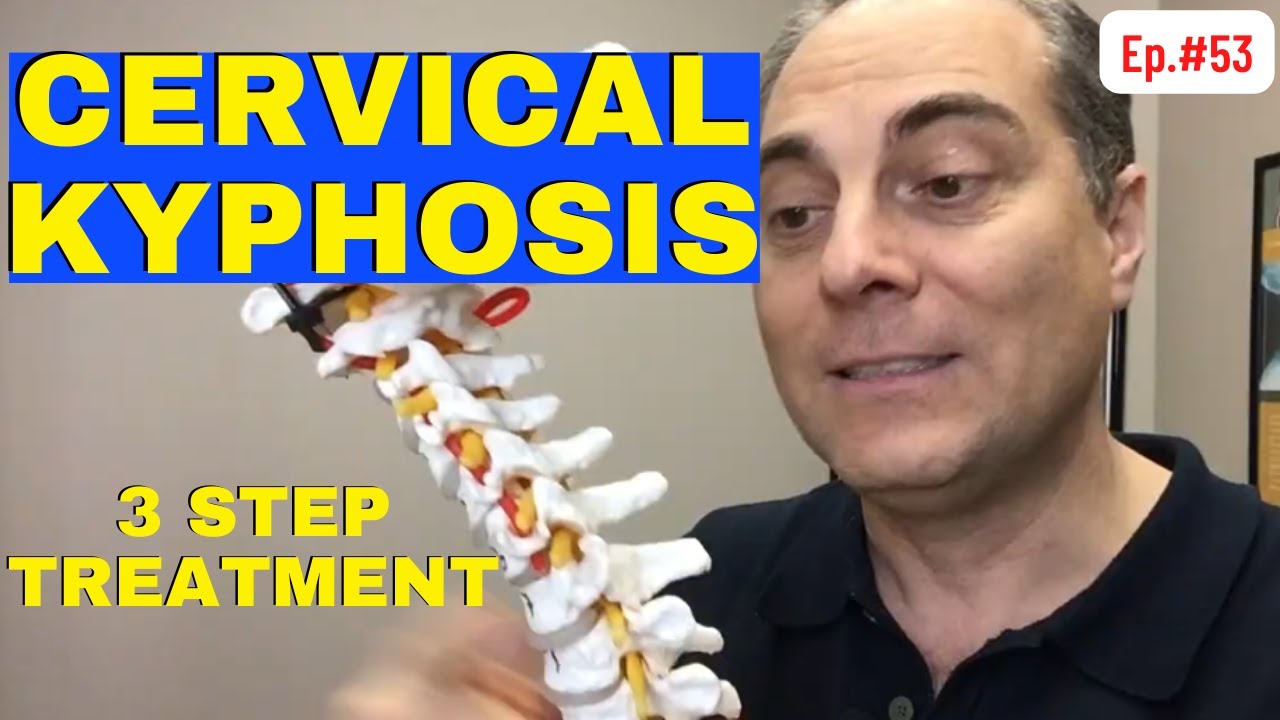 Kyphosis Symptoms And Causes Mayo Clinic