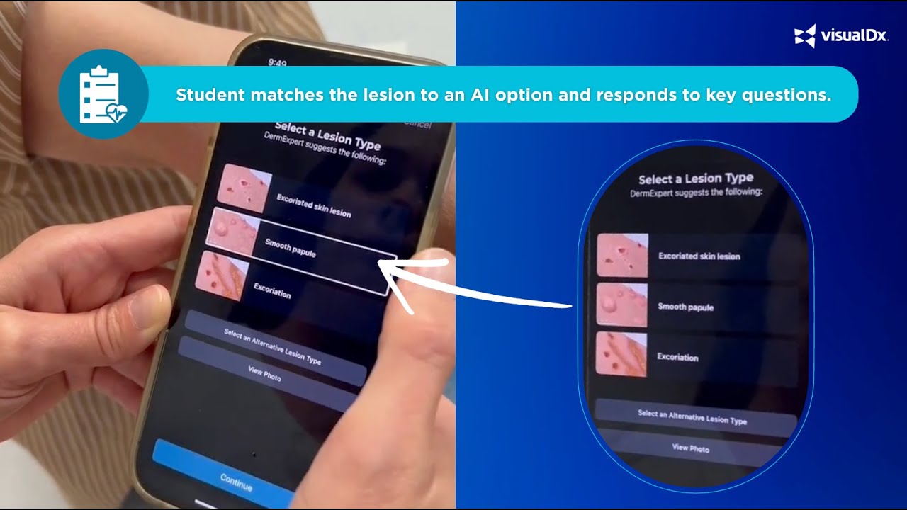 Teaching Dermatology Fundamentals with Skin Rash Simulation and AI ...