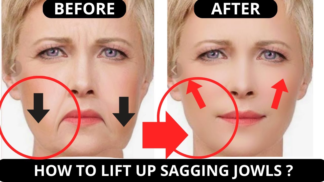 Face Lifting Exercises For Jowls And Laugh Lines Saggy Skin Marionette