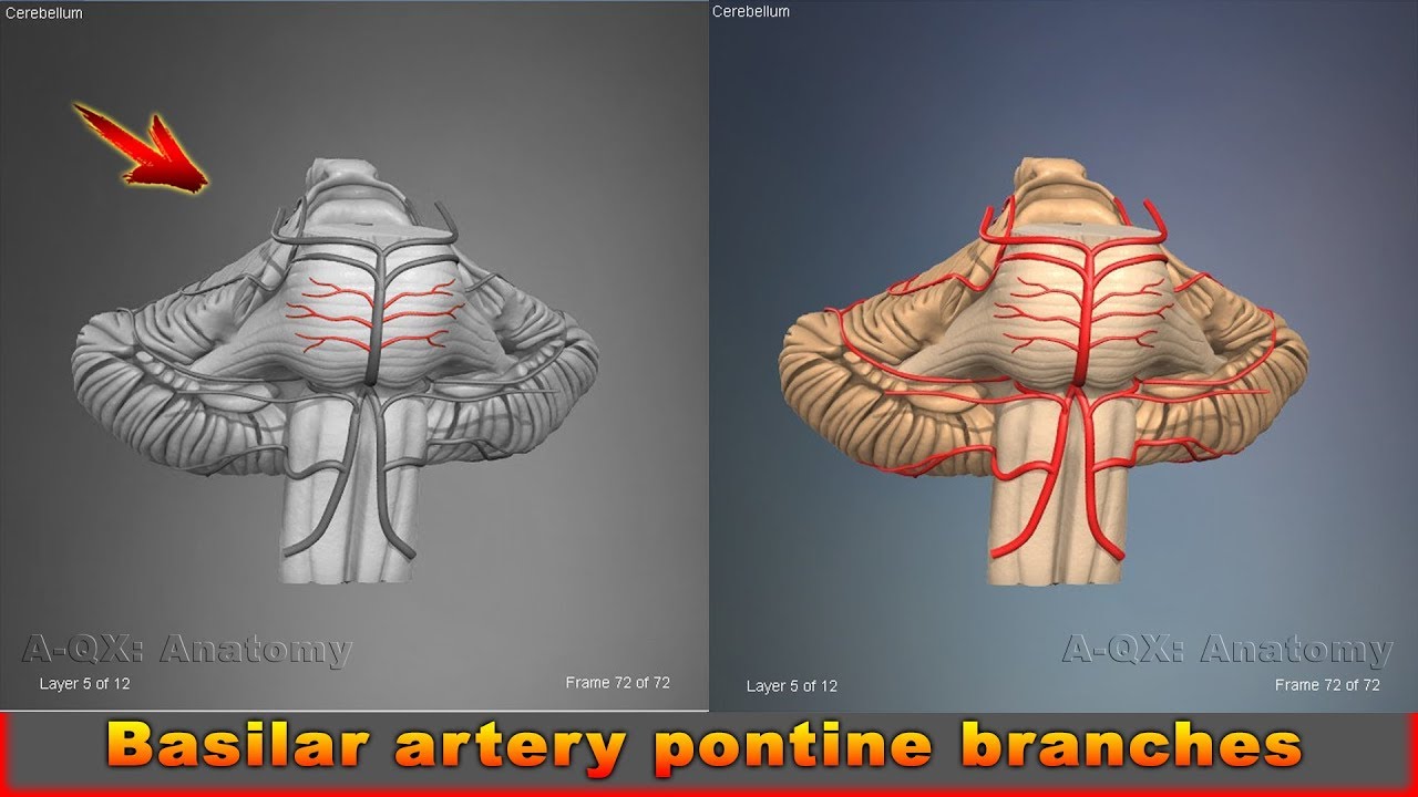 Basilar artery pontine branches | Arteries of head and neck | 3D Human ...
