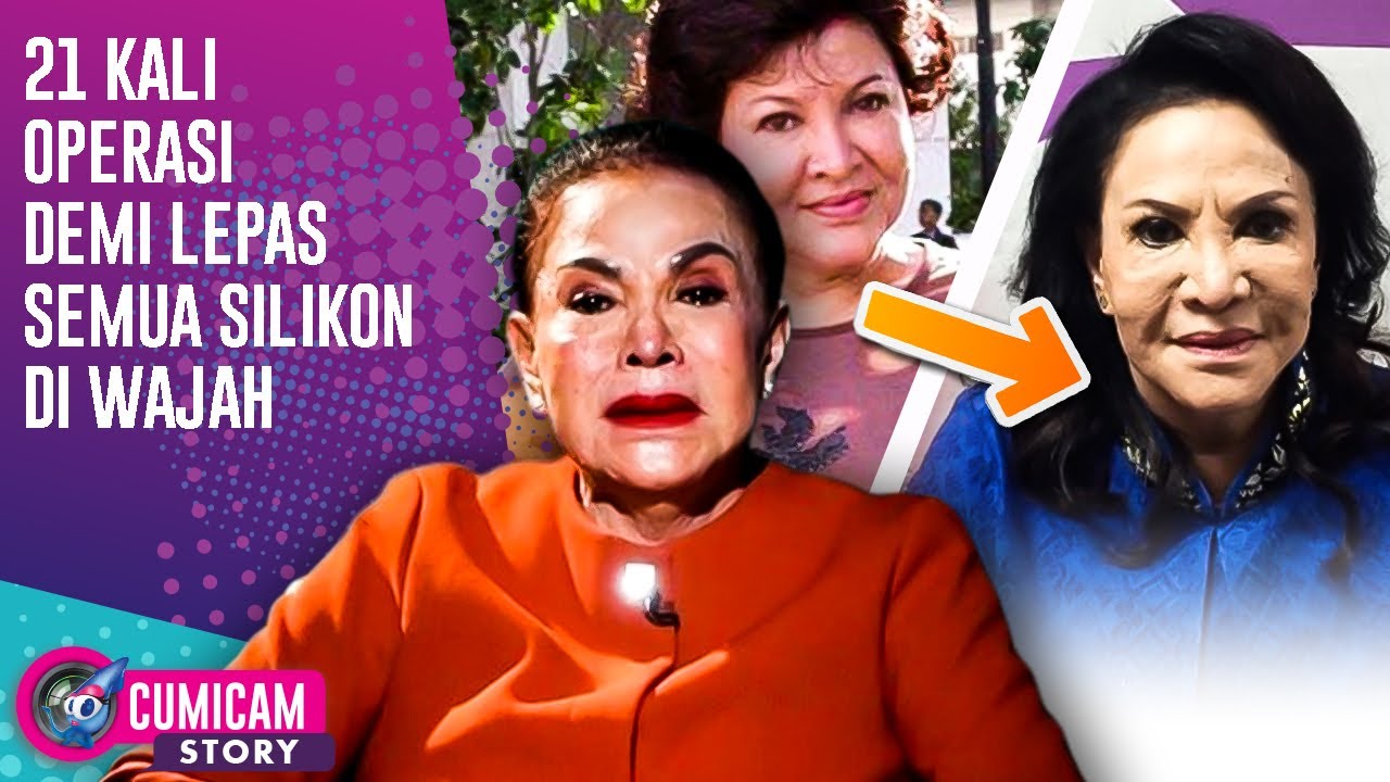 Curhat Pilu! Mpok Atiek Berjuang 3 Tahun Lepaskan Silikon yang Sudah ...
