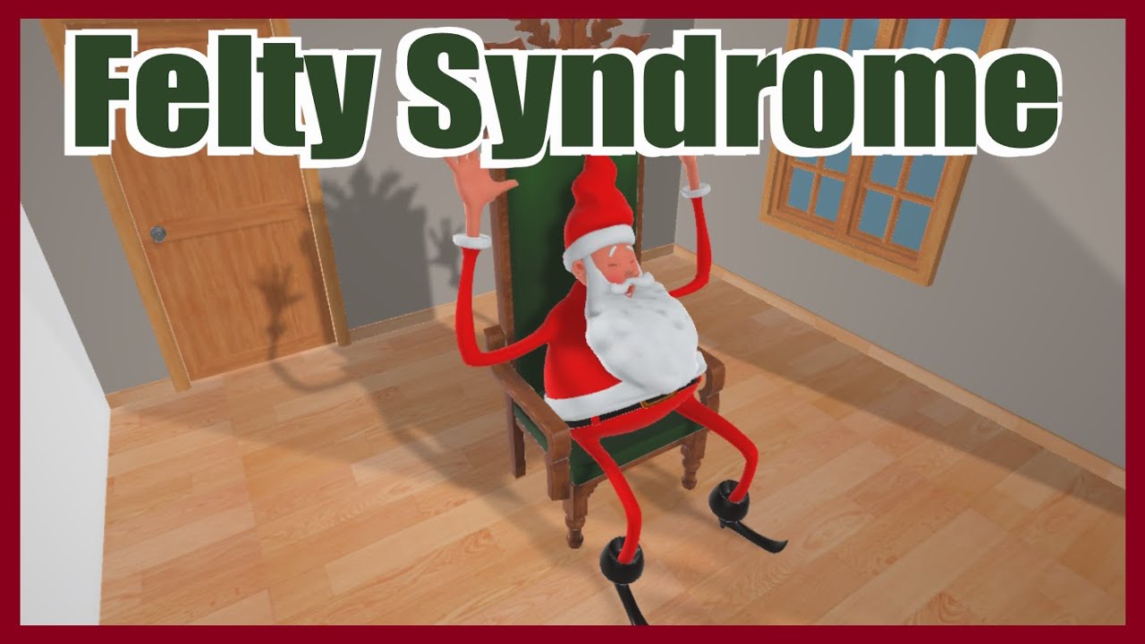 Felty Syndrome SciELO Brasil Rituximabe Na Síndrome De Felty