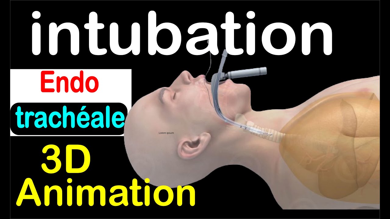 Réanimation : l'intubation endotrachéale 3D animation - YouTube