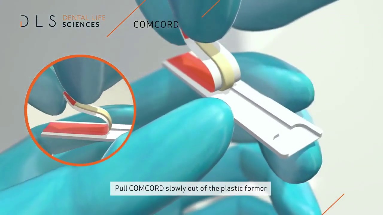 Comcord Composite And Fibre Matrix - YouTube