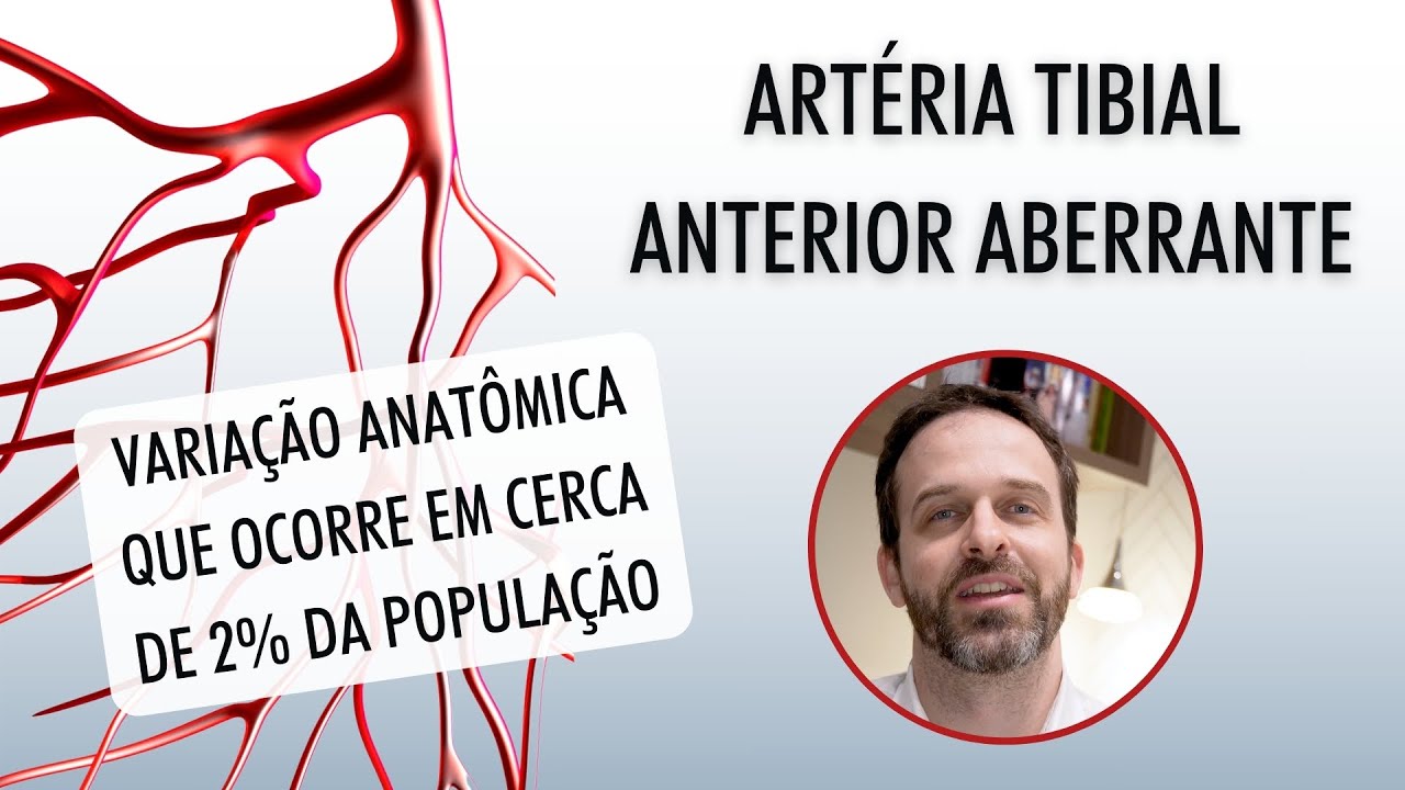 Tibialis Anterior Insertion