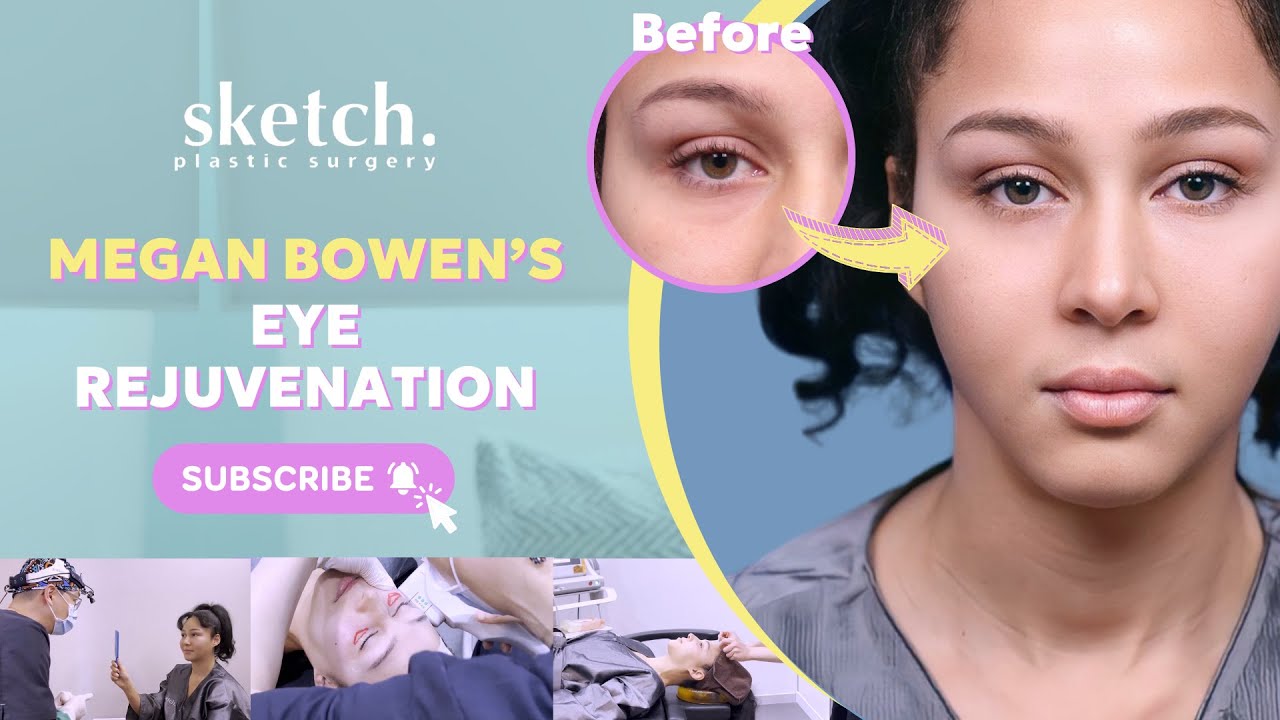 Youtuber Megan Bowen Came to Sketch Plastic Surgery to Get Her Eyes Rejuvenated - YouTube