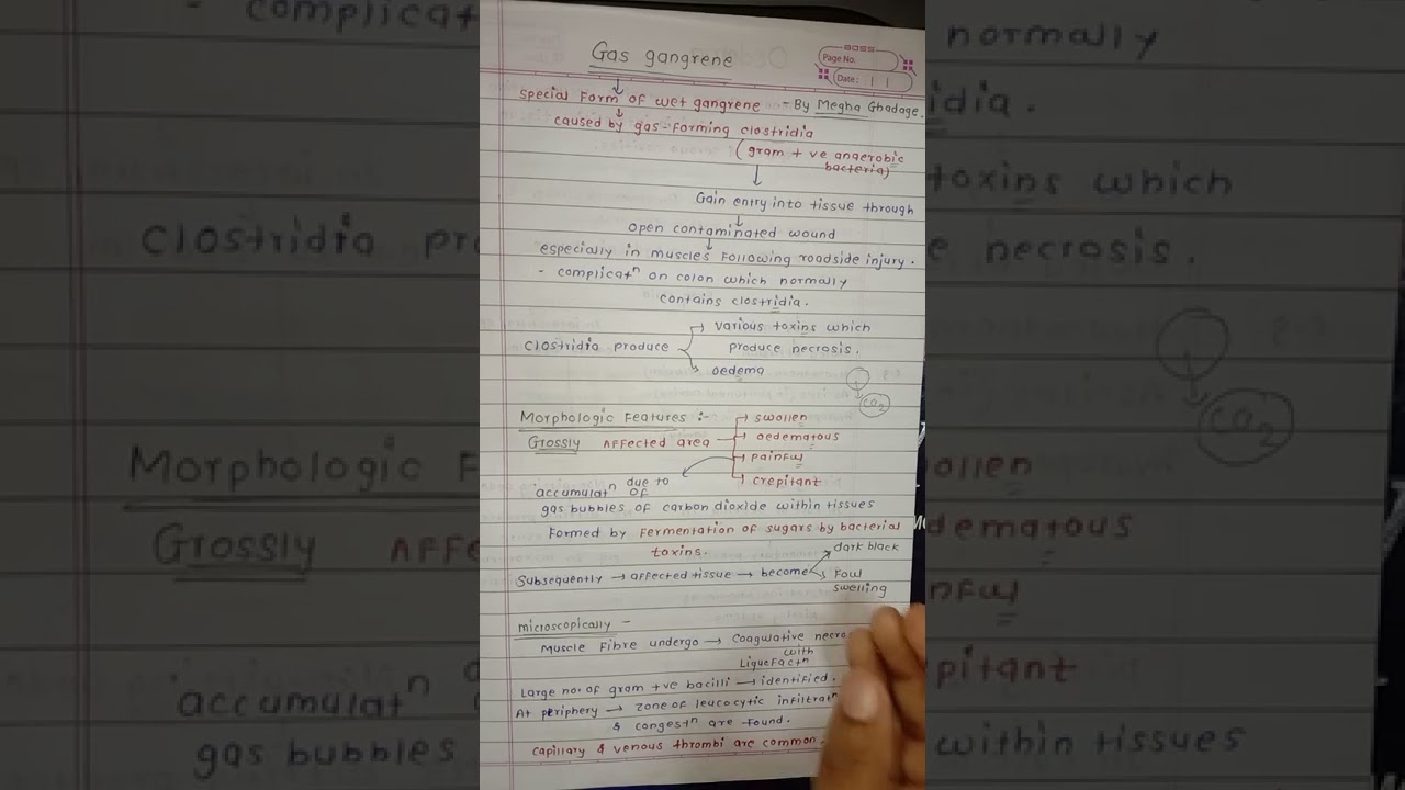 Gas Gangrene |Gangrene |from Harsh Mohan pathology #pathology - YouTube