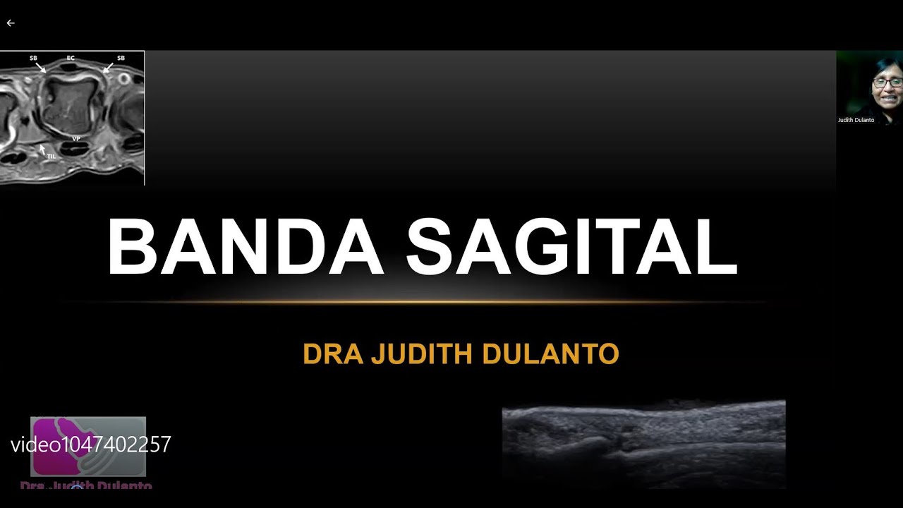 Como evaluar el aparato extensor de los dedos de la mano (banda sagital ...