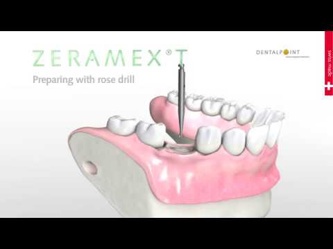 ZERAMEX®T Ceramic Implant Surgery Simulation