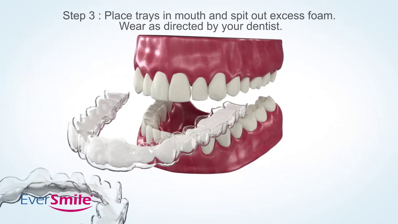 How to Clean Your Aligner or Retainer in 3 Simple Steps with WhiteFoam by EverSmile - YouTube