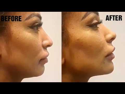Female Beautification by Dr Zack Ally - YouTube