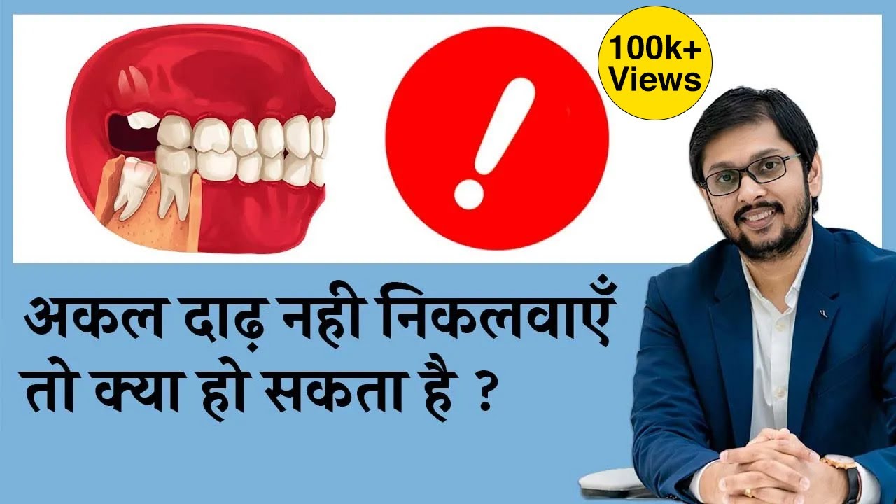 Akal Daad Ke Dard Ka Ilaj |अक्कल दाढ़ का इलाज | Akal Daad Dard Me Kya ...