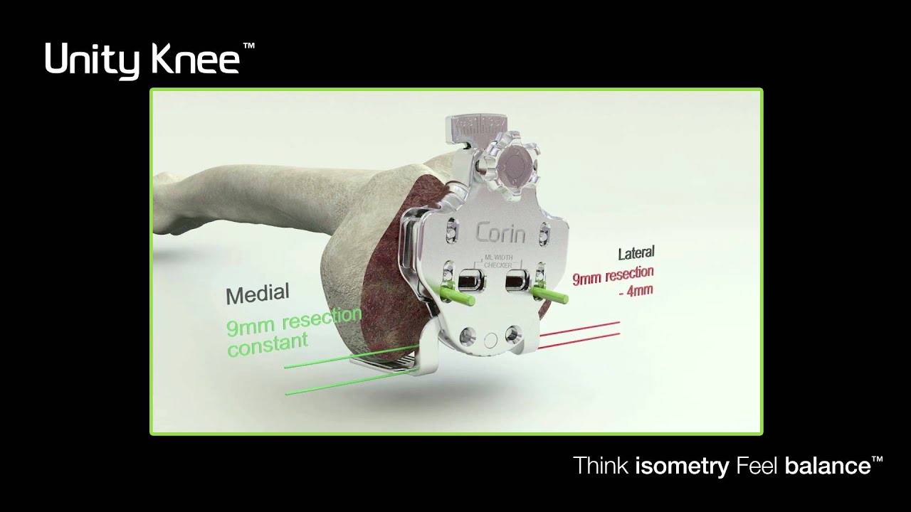 Unity Knee™ - Product Overview - YouTube