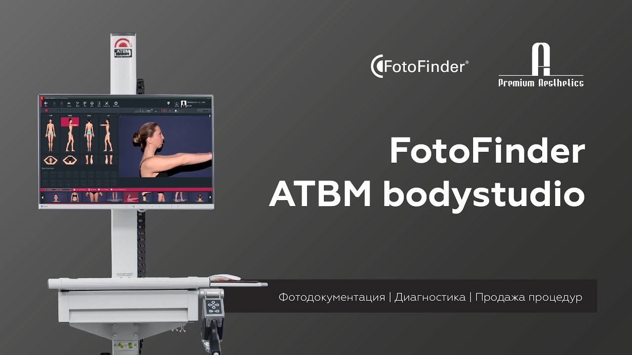 FotoFinder ATBM bodystudio. Фотодокументация. Диагностика. Продажа процедур. - YouTube