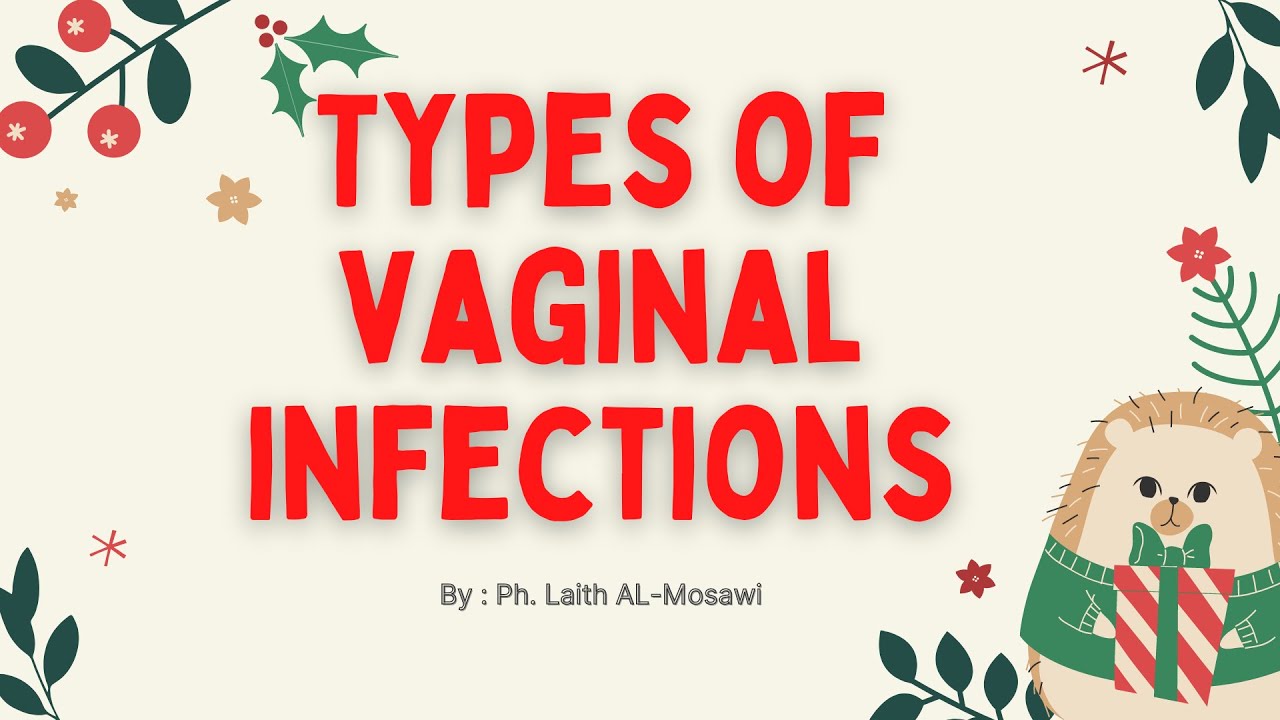 Types of Vaginal infections (Simple differentiation)-A pharmacist Print ...